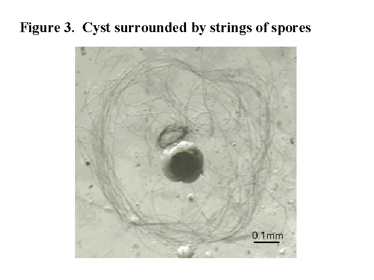 Figure 3. Cyst surrounded by strings of spores